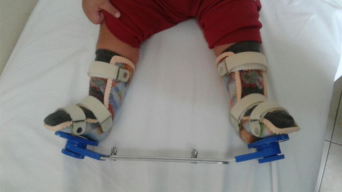 Protez Ortez ve Biyomekanik | Sağlıklı Yaşam Uygulama ve Araştırma ...